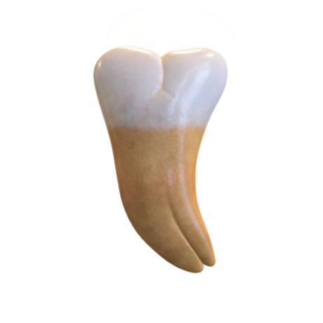 p3d.in - TERCER MOLAR INFERIOR 48